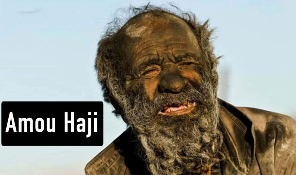 O homem mais sujo do mundo: iraniano não toma banho há 60 anos